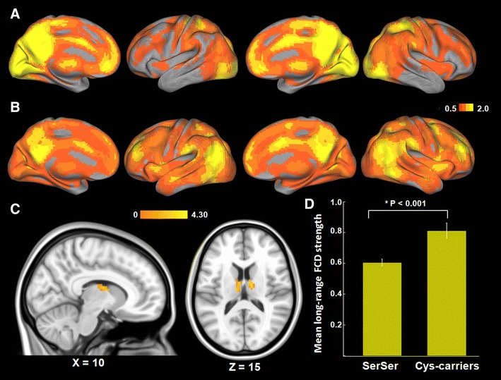DISC1 Ser704Cys impacts thalamic-prefrontal connectivity | FAN Lab@CASIA
