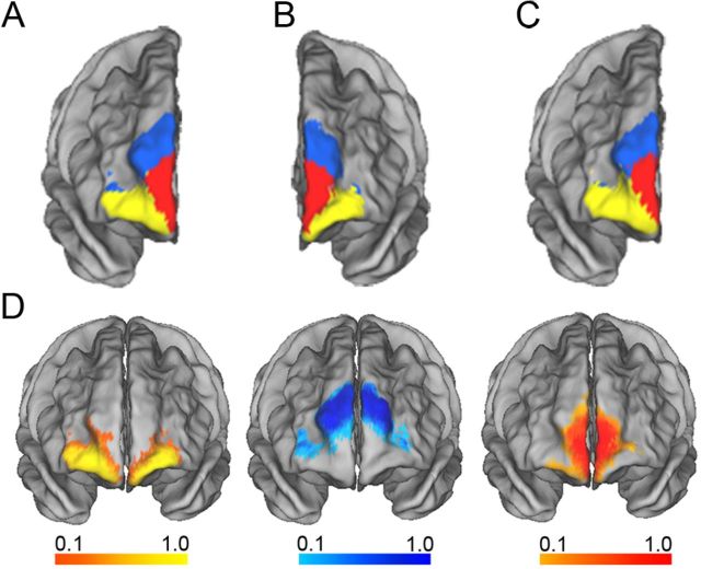 Connectivity-based parcellation of the human frontal pole with ...