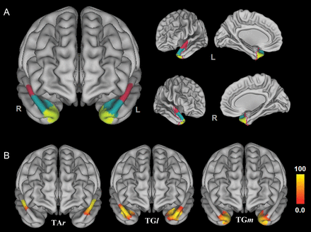 Connectivity-based parcellation of the human temporal pole using diffusion tensor imaging | FAN ...