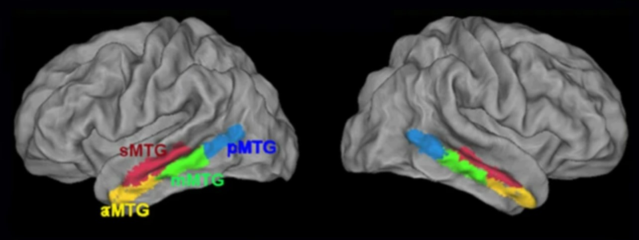 Tractography-based Parcellation of the Human Middle Temporal Gyrus ...
