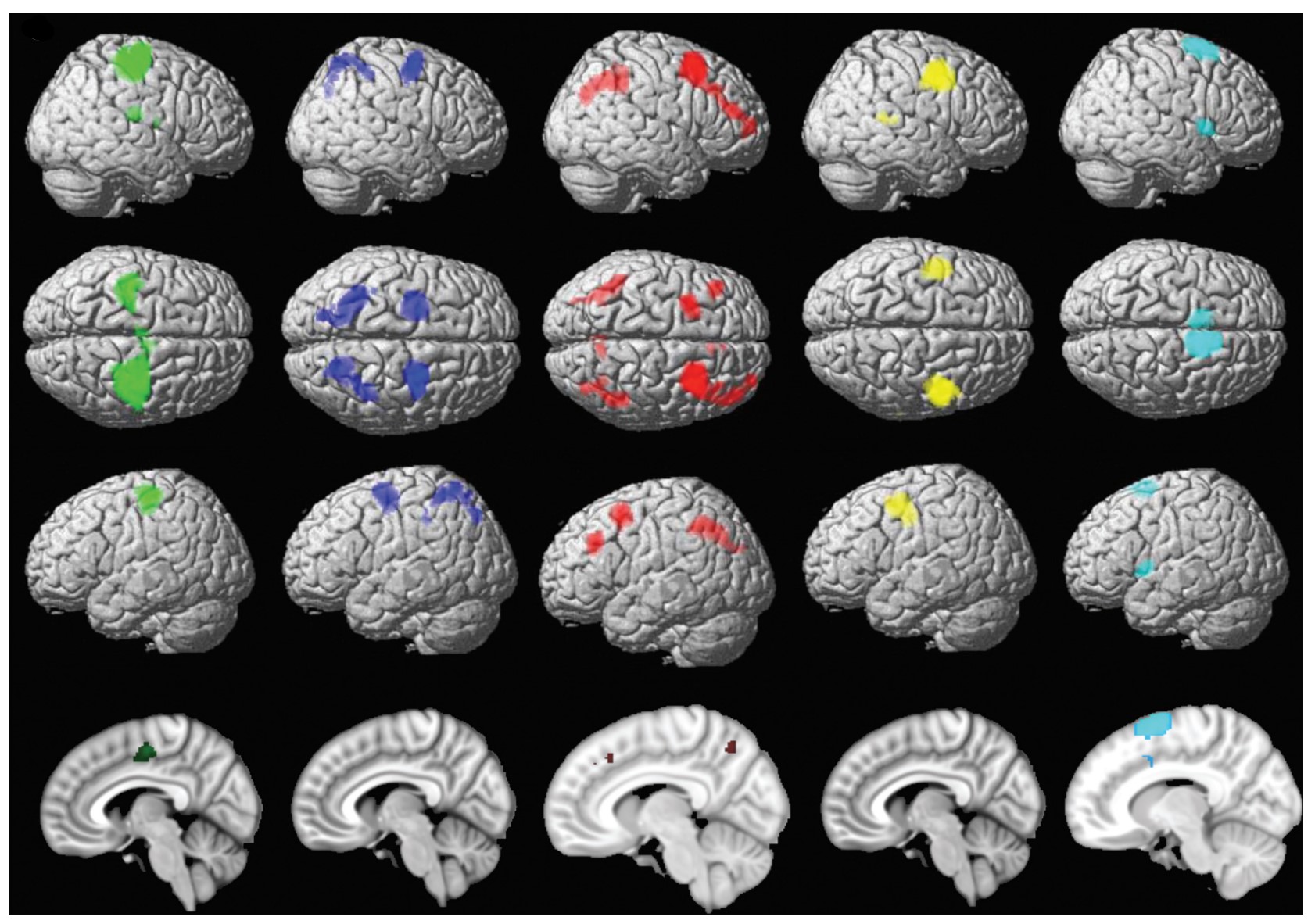 The right dorsal premotor mosaic: organization, functions, and ...
