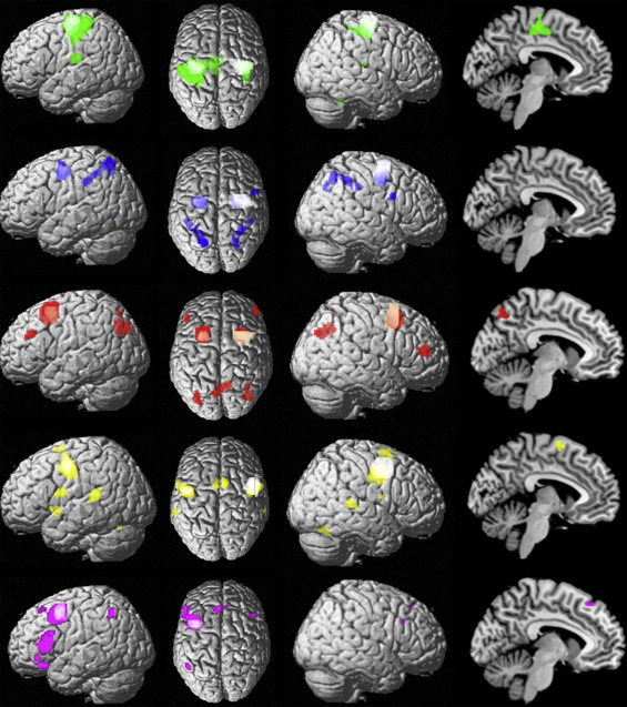 The Heterogeneity Of The Left Dorsal Premotor Cortex Evidenced By Multimodal Connectivity Based